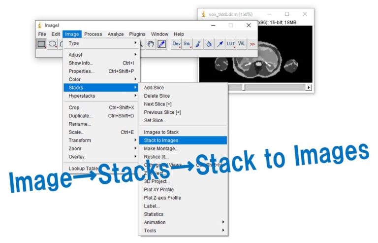 ImageJの使い方 1｜Tools for RadTech
