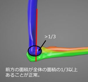 肘関節側面撮影 Elbow lateral view – Tools for RadTech