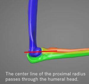 Elbow lateral view – Tools for RadTech
