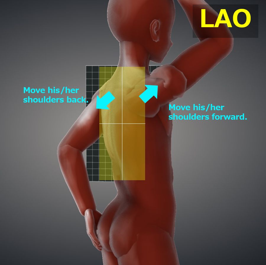 Thoracic spine oblique view|Tools for RadTech Thoracic spine oblique view|Tools for RadTech