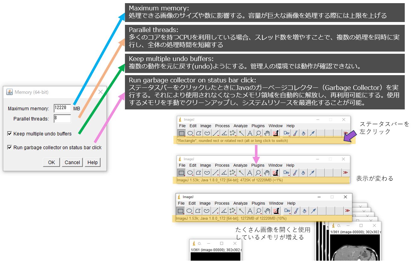 ImageJの使い方 2 ーEditメニュー編ー｜Tools for RadTech