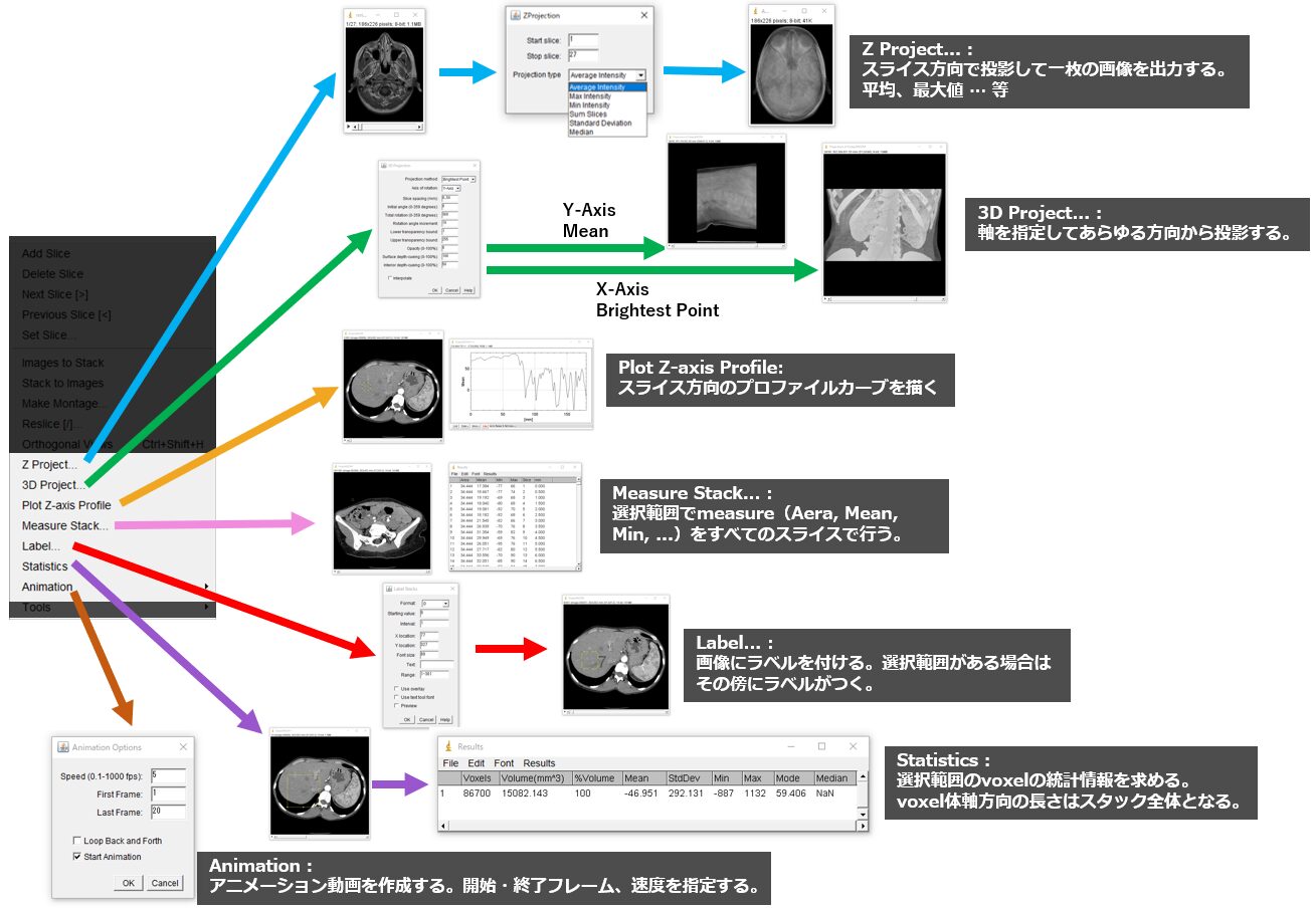 ImageJの使い方 3 ーImageメニュー編ー｜Tools for RadTech