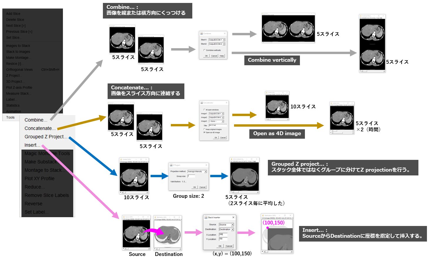 ImageJの使い方 3 ーImageメニュー編ー｜Tools for RadTech