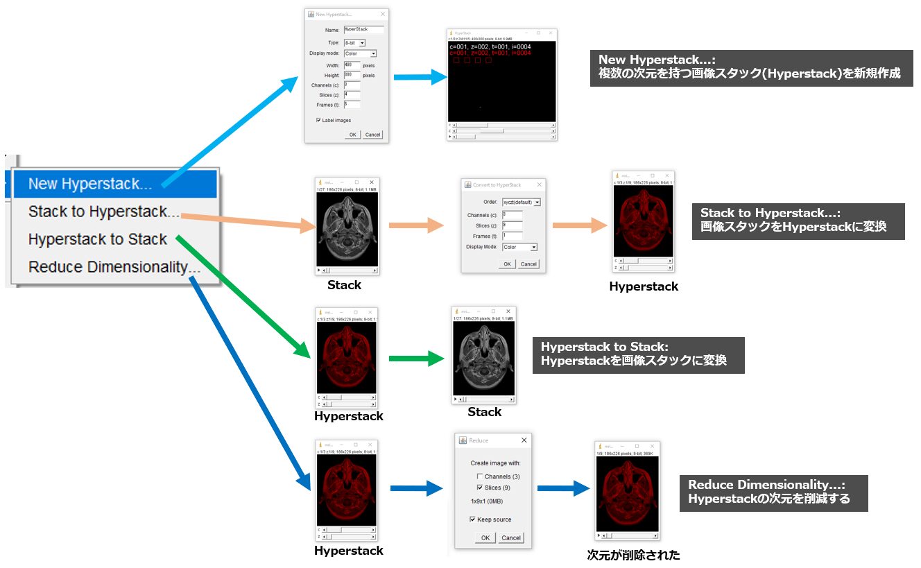 ImageJの使い方 3 ーImageメニュー編ー｜Tools for RadTech