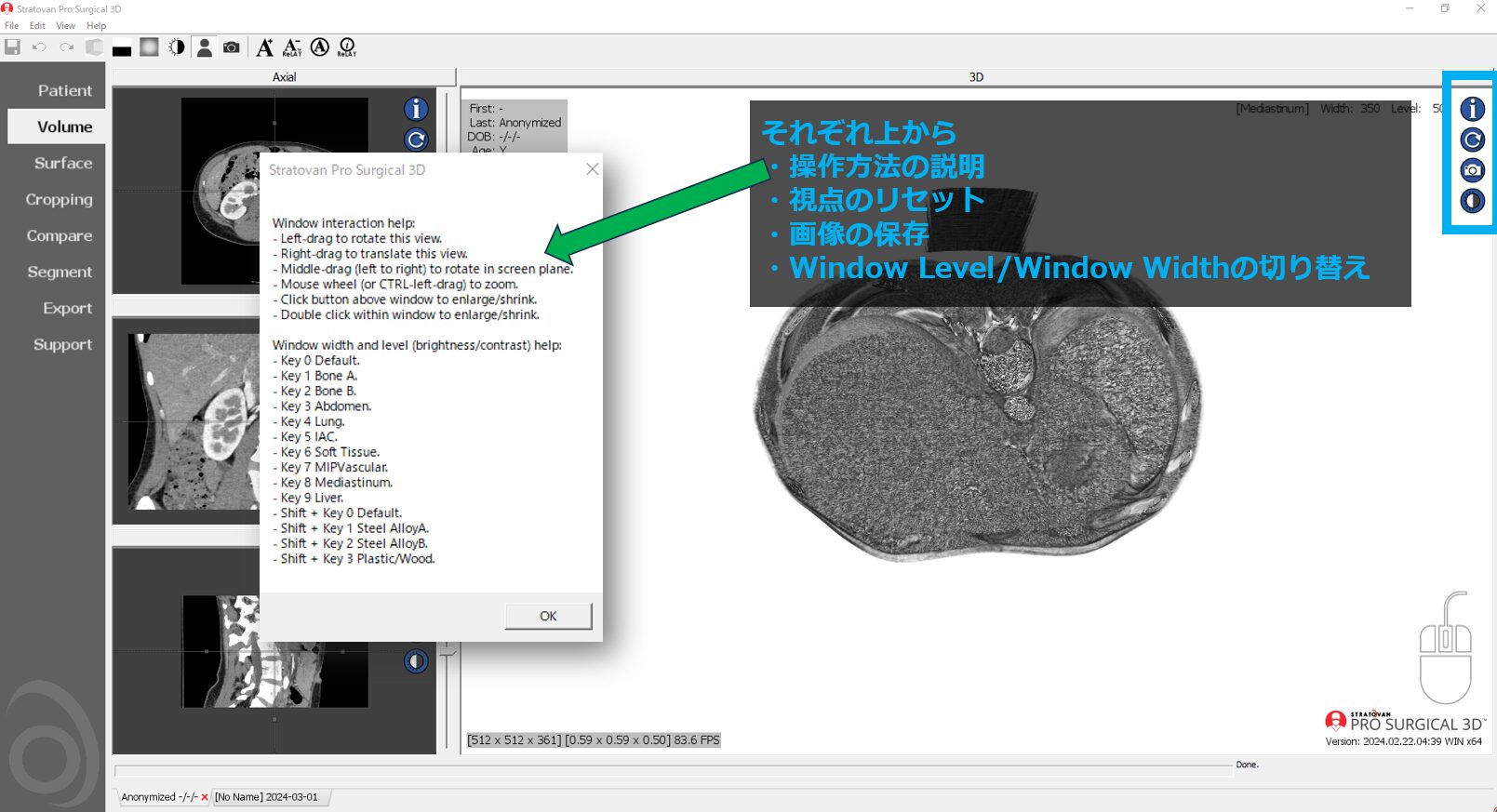 【DICOM viewer】PRO SURGICAL 3D｜Tools for RadTech