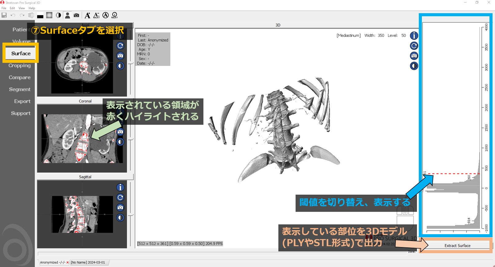 【DICOM viewer】PRO SURGICAL 3D｜Tools for RadTech