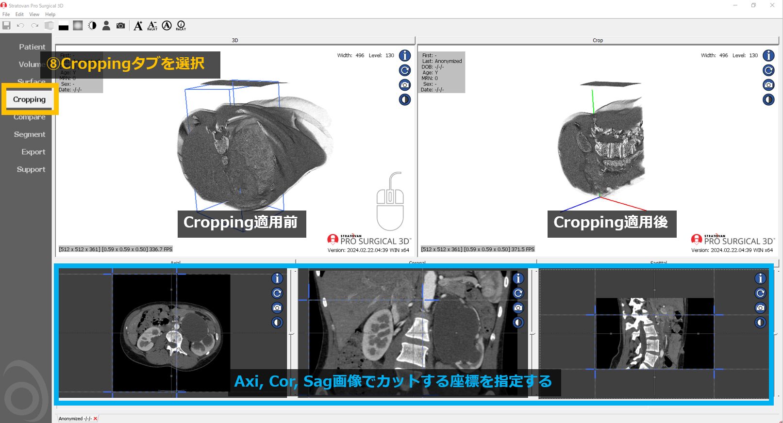 【DICOM viewer】PRO SURGICAL 3D｜Tools for RadTech