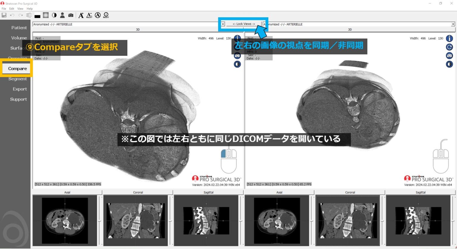 【DICOM viewer】PRO SURGICAL 3D｜Tools for RadTech