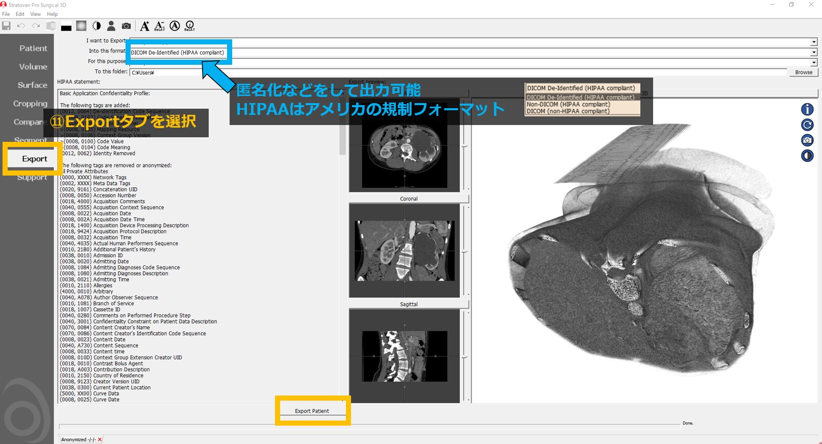 【DICOM viewer】PRO SURGICAL 3D｜Tools for RadTech