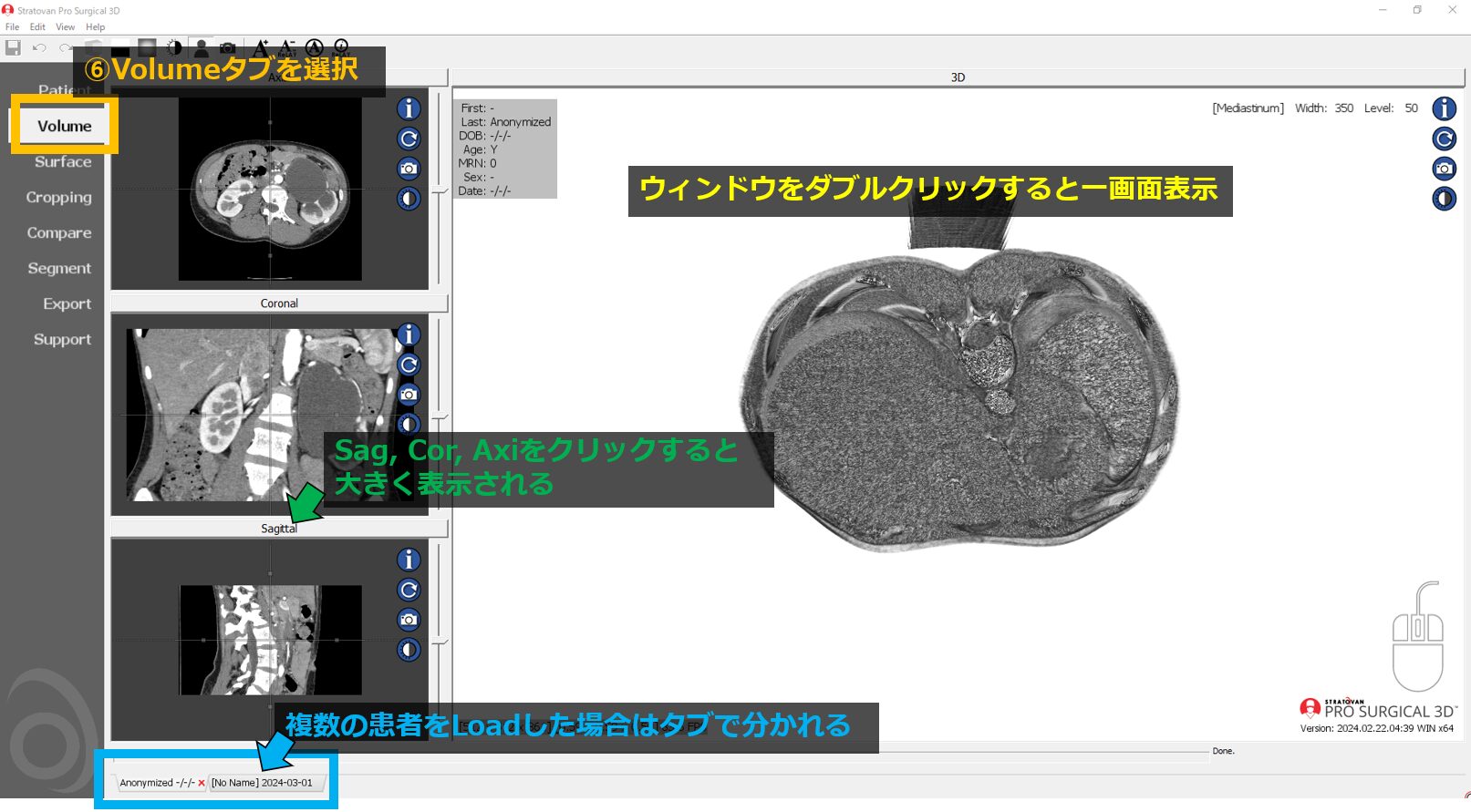 【DICOM viewer】PRO SURGICAL 3D｜Tools for RadTech