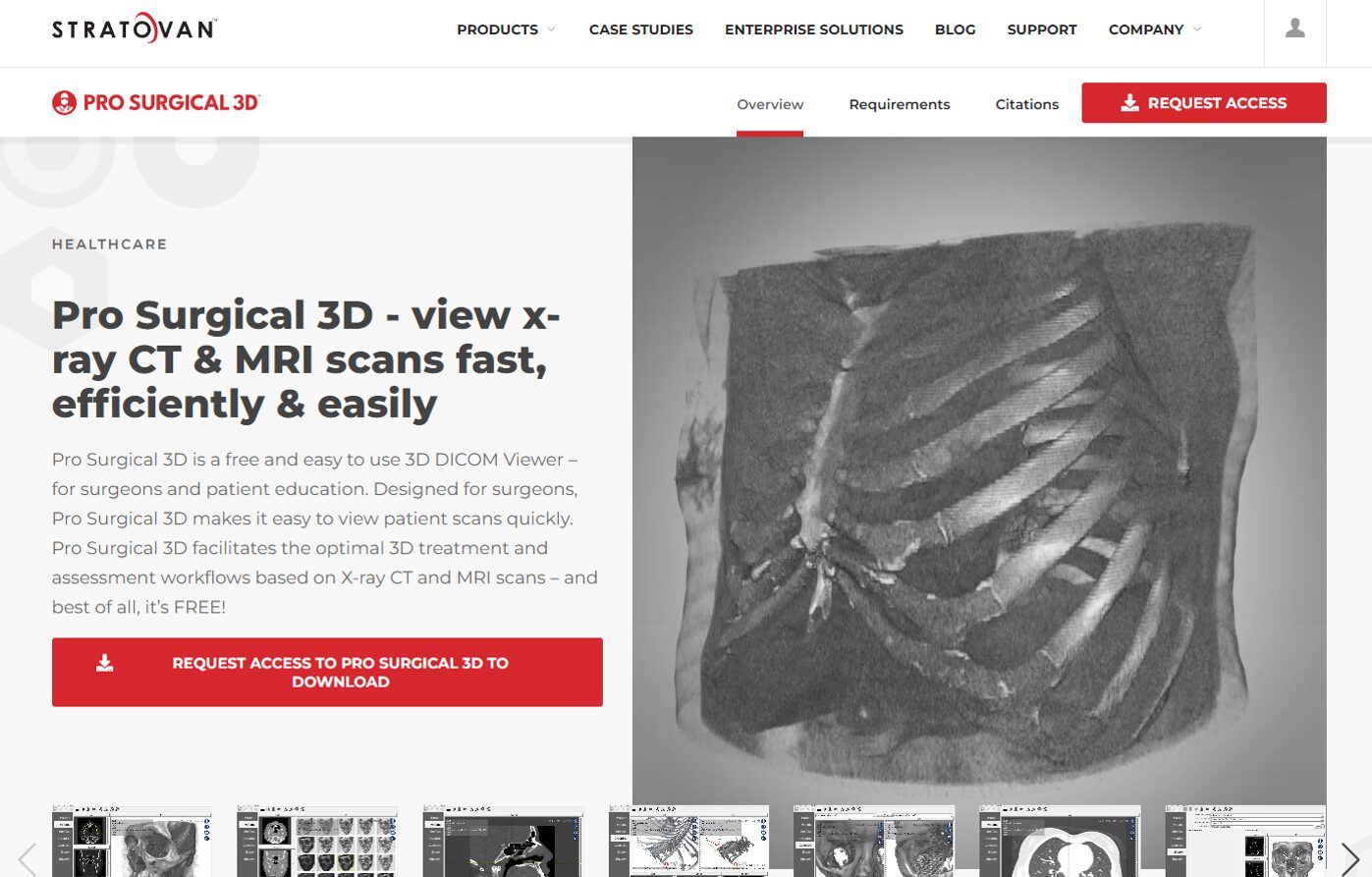 【DICOM viewer】PRO SURGICAL 3D｜Tools for RadTech