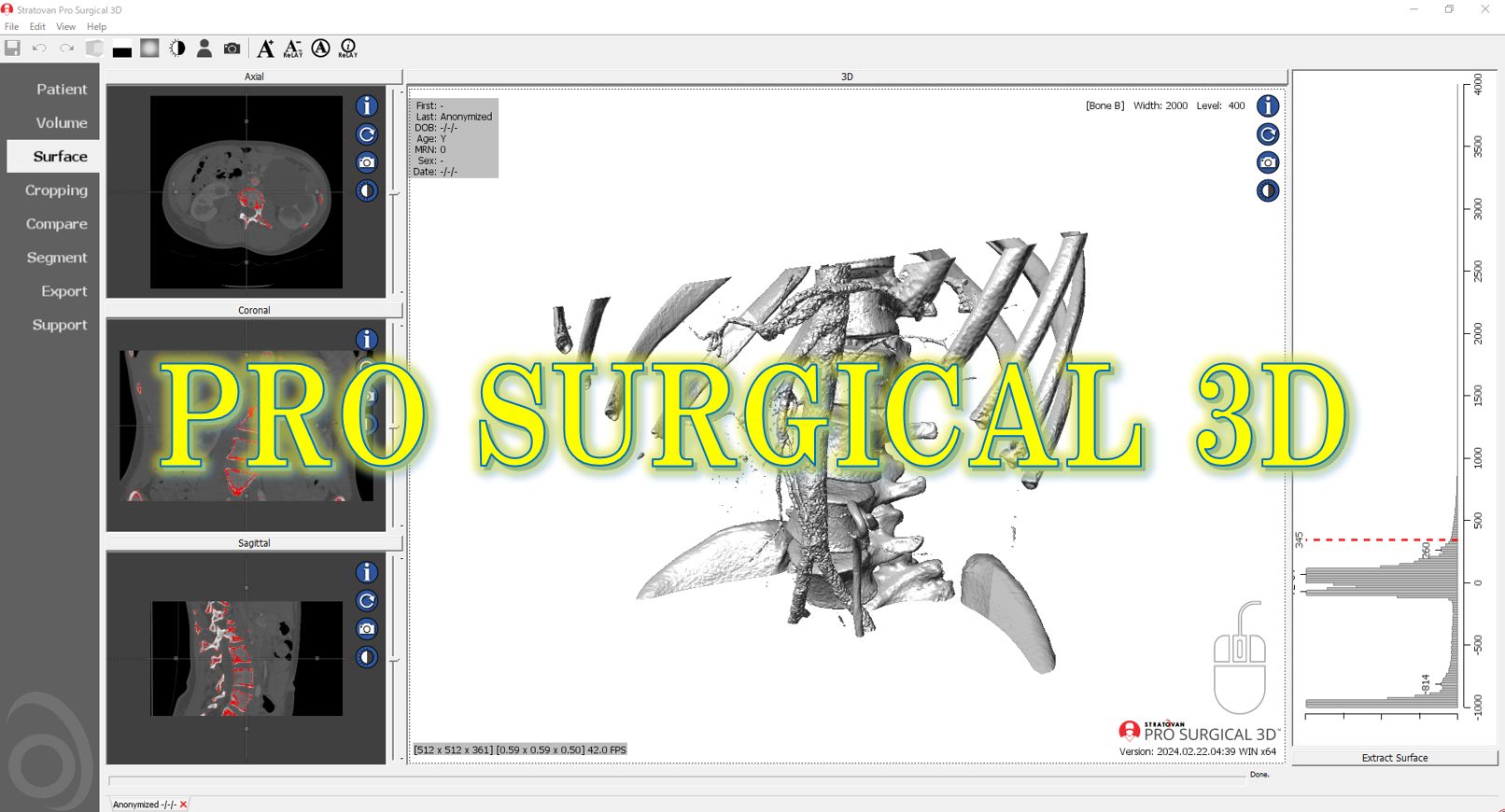 【DICOM viewer】PRO SURGICAL 3D｜Tools for RadTech