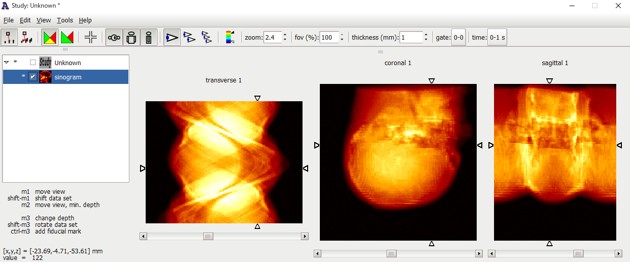 画像再構成ソフトウェア ～TIGRE～｜Tools for RadTech